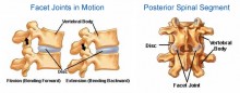 Portsmouth and Chichester Spine Surgeon | SpineInfo.co.uk | Facet Joint ...